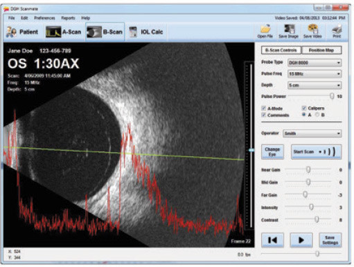DGH Scanmate 8000 Portable B-Scan - Premier Ophthalmic Services