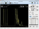Portable A-Scan 6000, Scanmate Portable A-Scan