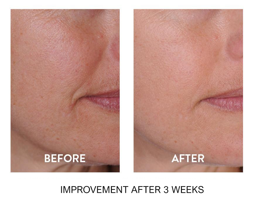 Glycolic Rectifying Treatment Creme +Retinol | Moisturizers/spf | Joli ...