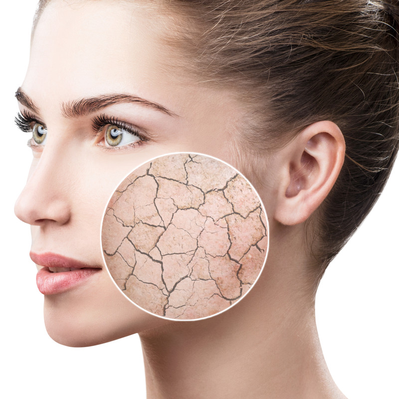 DRY RESCUE WINTER TIPS THAT KEEP YOUR SKIN MOIST - Joli Visage Store