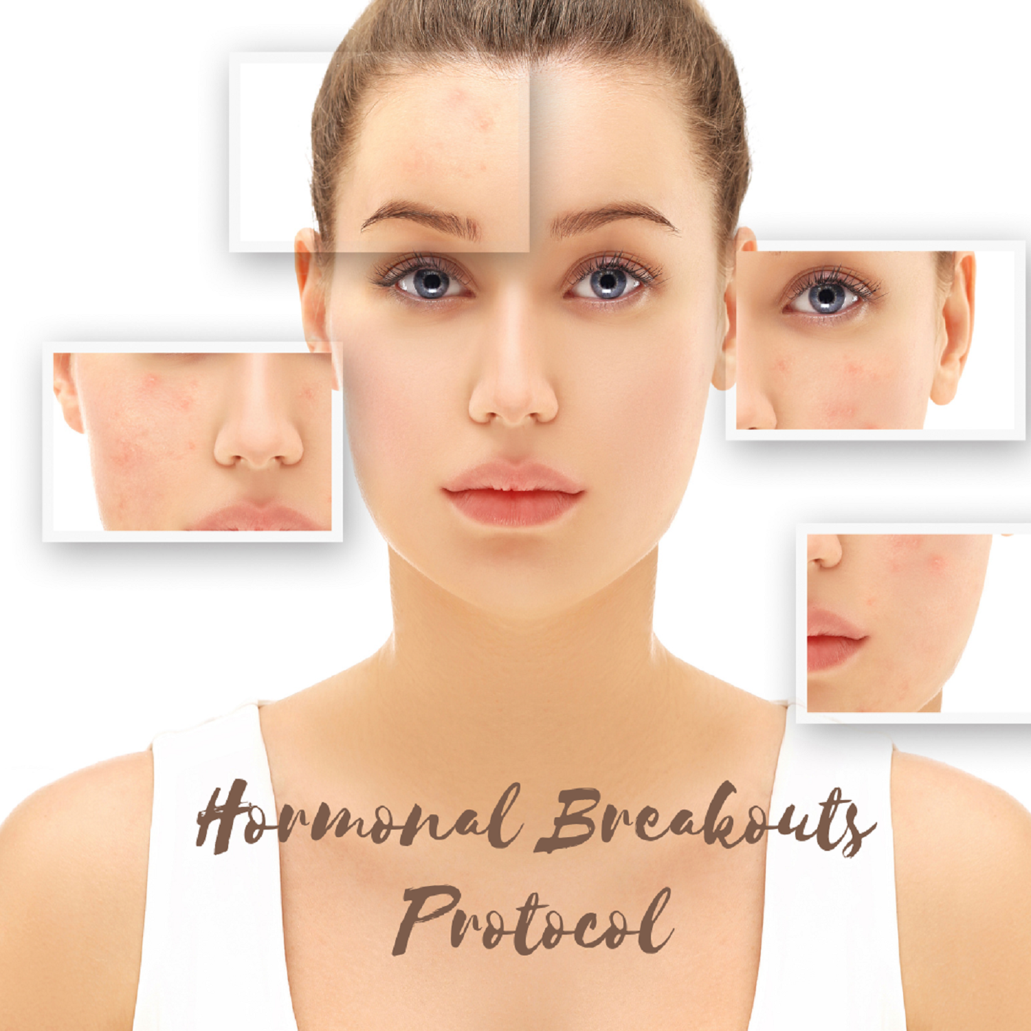 Skincare Protocol for Hormonal Breakouts - Joli Visage Store
