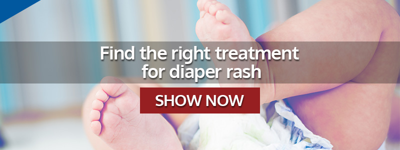 Dealing With Diaper Rash: How to Prevent It and Make It Go Away ...