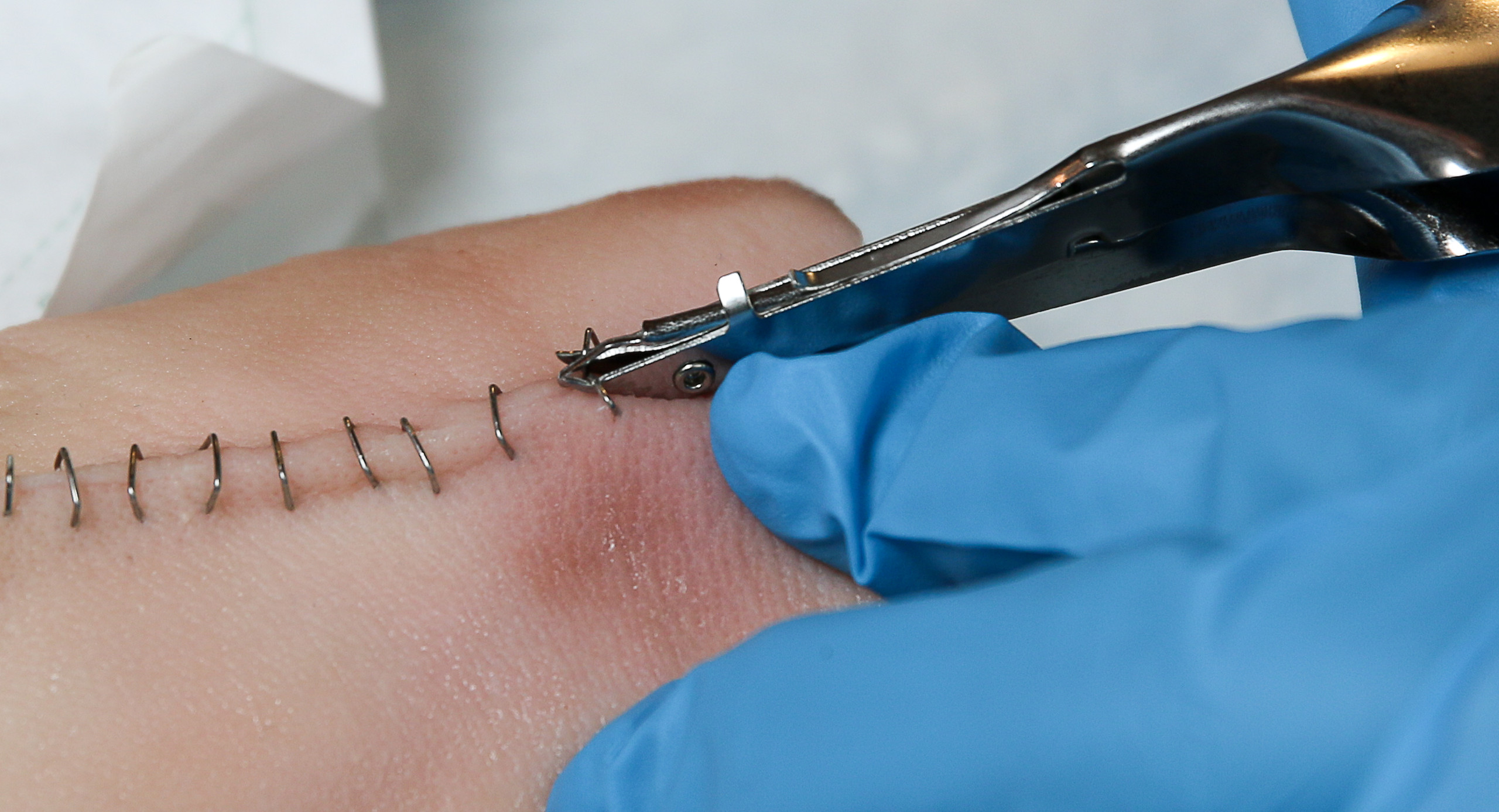 Suture and Staple Kit| Wound Survival First Aid Kit | Prepper Wound Kit ...