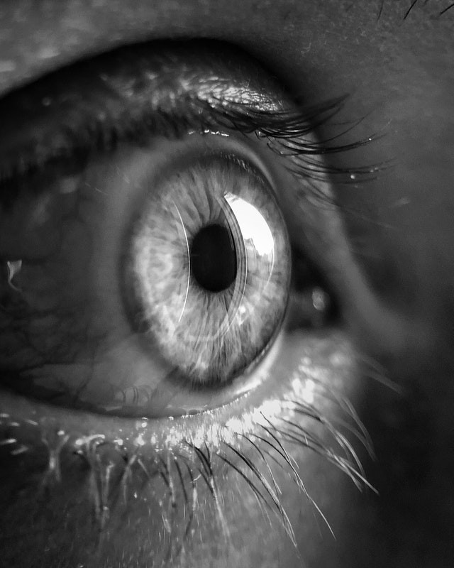 Why Do I See Eye Webs? - WebEyeCare