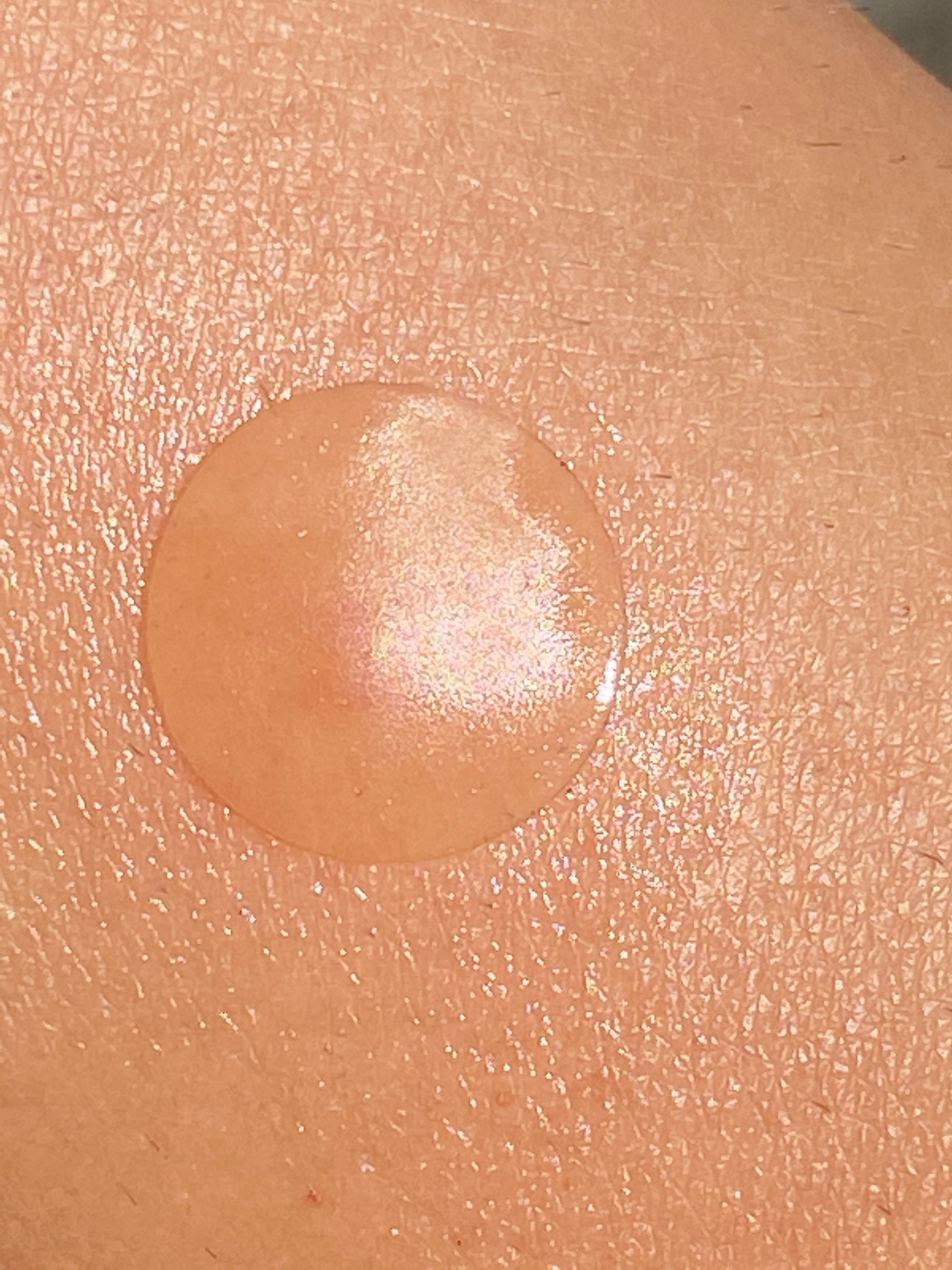 Mollenol hydrocolloid patches