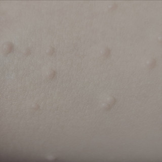 Mollenol for better skin. Mollenol Sensitive and Hydrocolloid Patches.