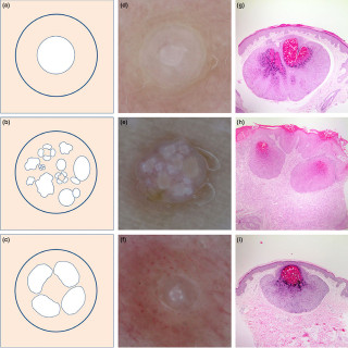 Mollenol for better skin