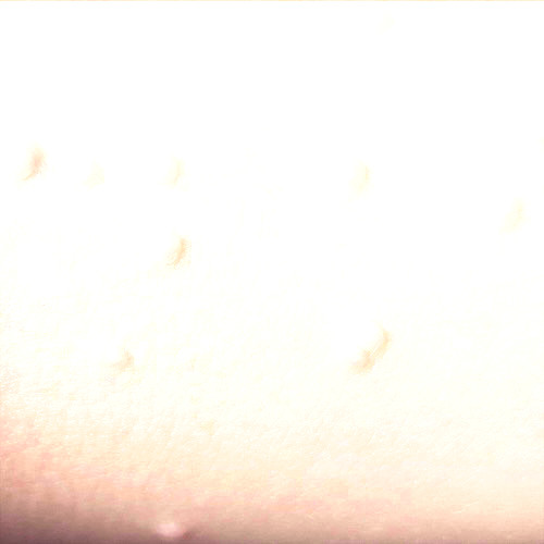 Mollenol for better skin. Mollenol Sensitive and Hydrocolloid Patches.