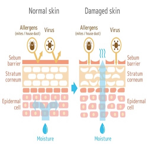 Mollenol for better skin. Mollenol Sensitive and Hydrocolloid Patches.