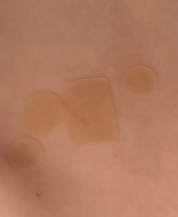 How to Apply Mollenol and Patches: Step-by-Step Guidance - Mollenol