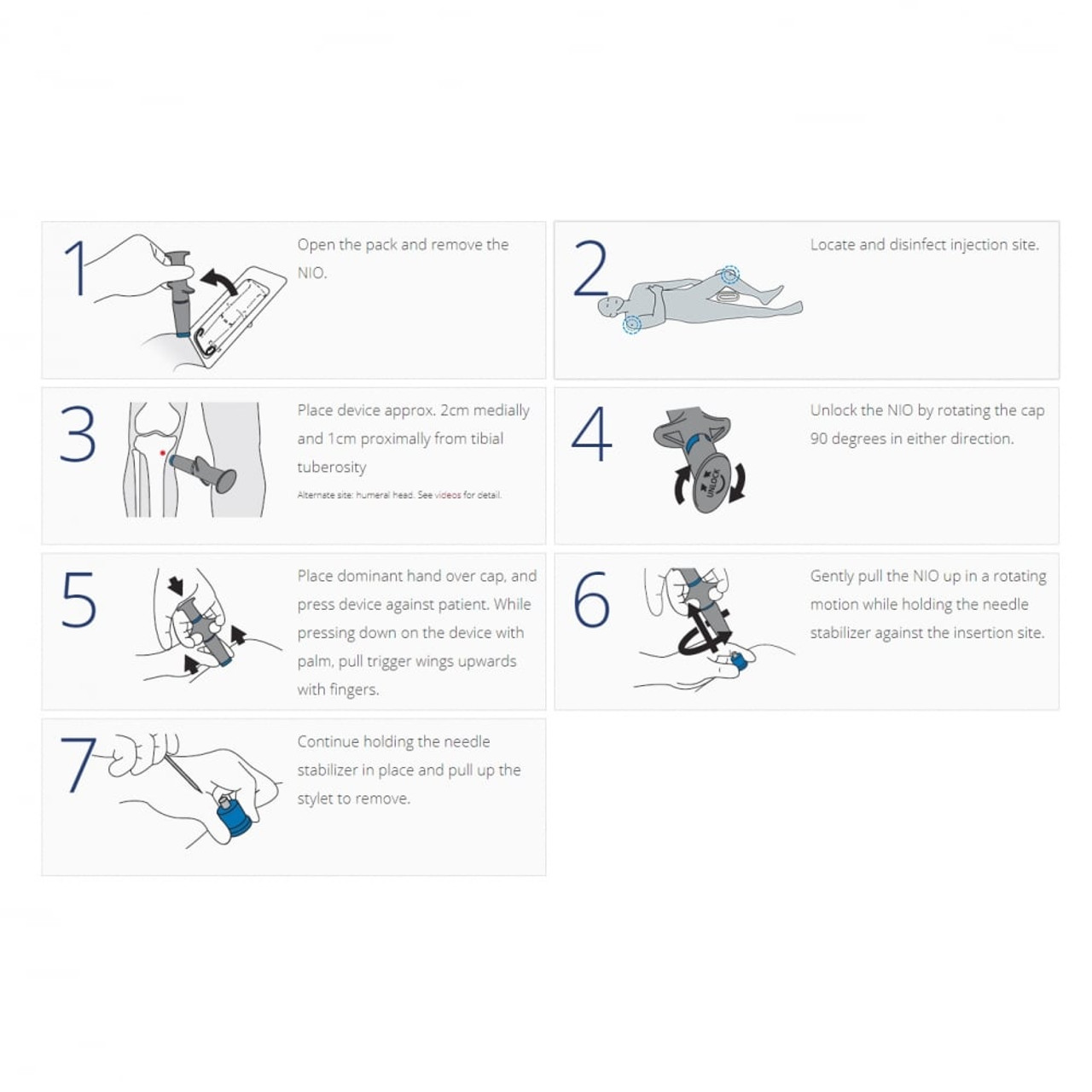 NIO (New Intraosseous Device) | Intraosseous (IO) | DS Medical
