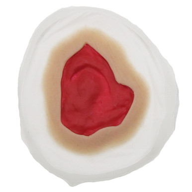 SiMoulage™ SFX Silicone Pressure Sore / Broken Down Skin Area | Moulage | DS Medical
