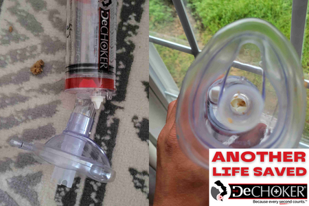 Life Save #311: Dechoker Saves 1-Year-Old from Hamburger - Dechoker