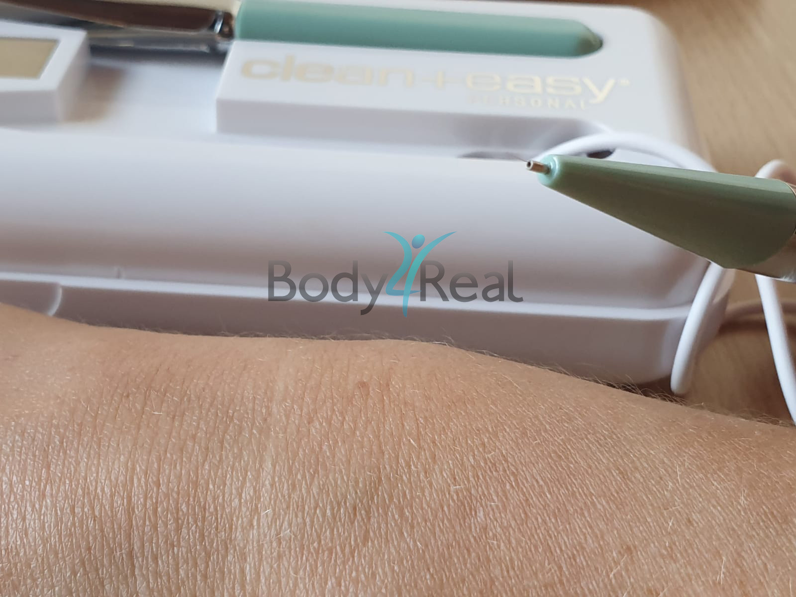 Clean & Easy Deluxe Home Electrolysis Kit