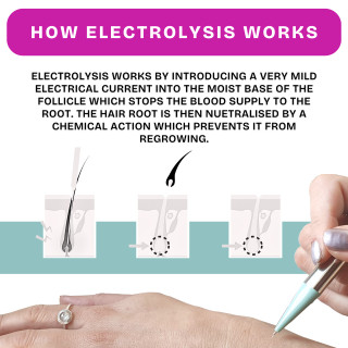 Clean & Easy Deluxe Home Electrolysis Kit