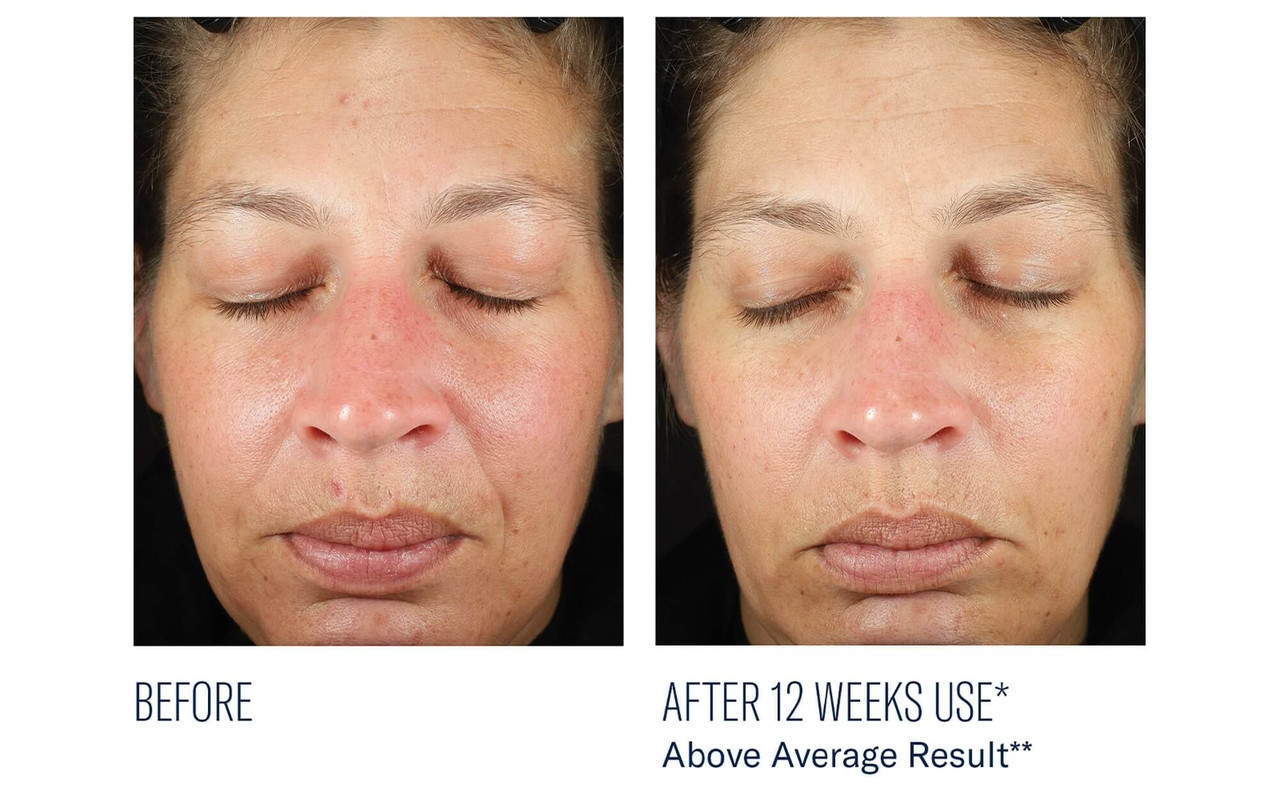 Skinbetter BioRewind Supplement 60 Caps | SkinElite