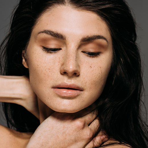 Got Polka Dots? Common Types of Facial Brown Spots