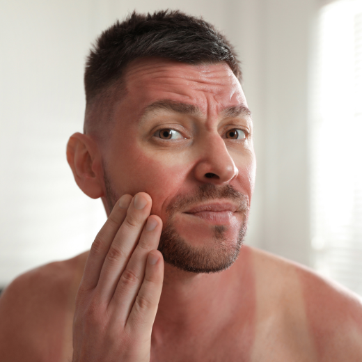 Skin Sensitivity: Is It Luck or Can You Make Your Skin Less Sensitive?