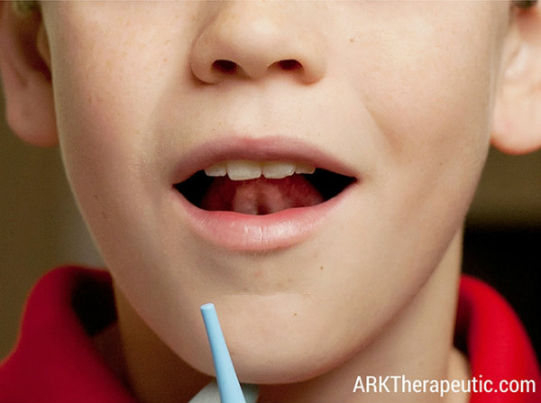 Tongue Tip Elevation Exercises - ARK Products, LLC