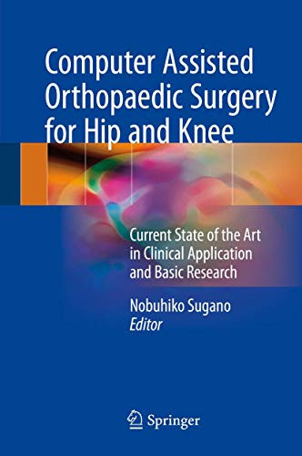 Computer Assisted Orthopaedic Surgery For Hip And Knee: Current State ...