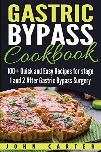 Gastric Bypass Cookbook: 100+ Quick and Easy Recipes for stage 1 and 2 ...