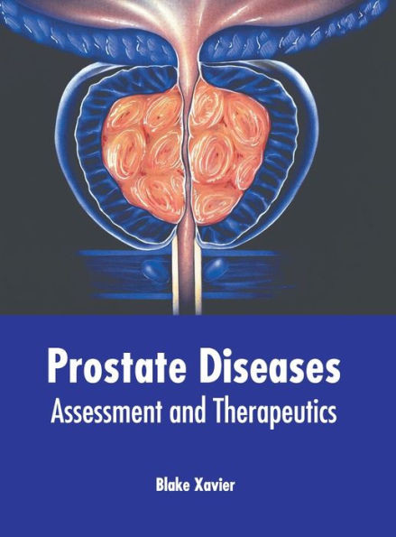 Prostate Diseases: Assessment and Therapeutics - Blake Xavier ...