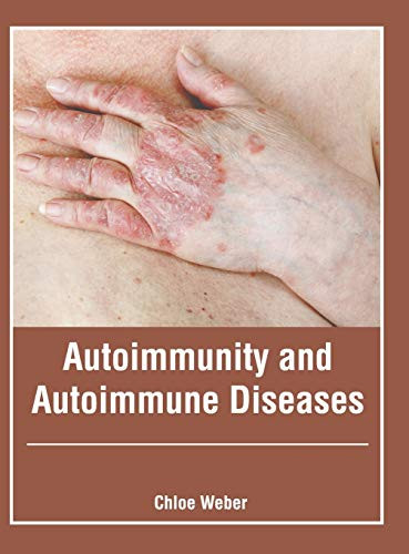 Autoimmunity And Autoimmune Diseases - Chloe Weber - 9781632426871 ...