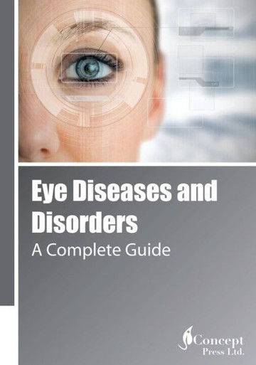 Eye Diseases and Disorders: A Complete Guide - Iconcept Press ...