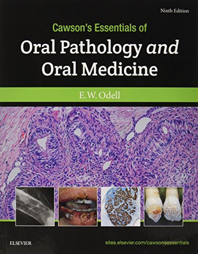 Cawson'S Essentials Of Oral Pathology And Oral Medicine - Edward W. Odell - 9780702049828 ...