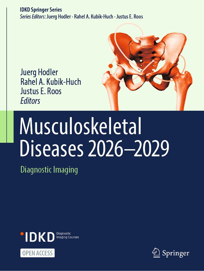 Musculoskeletal Diseases 2026–2029 - Paperback | BookPal