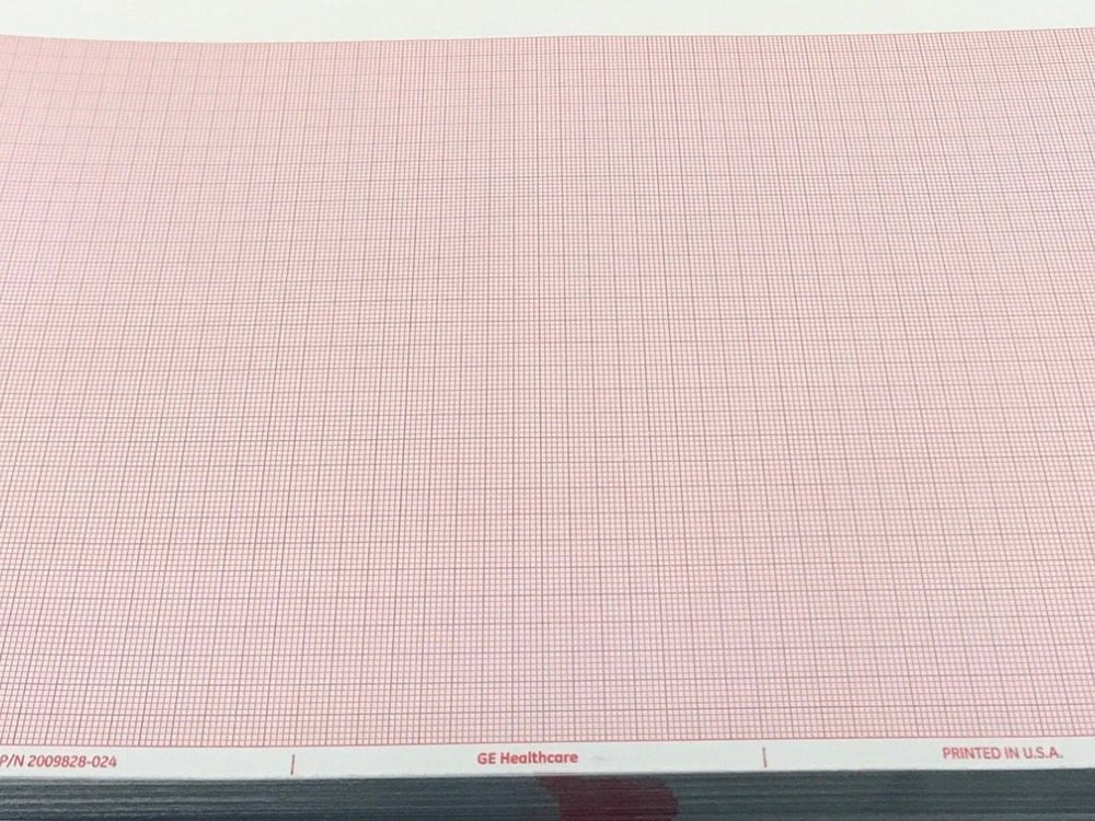 Modul Eli 250 EKG Paper - High-Quality Thermal Graph Paper for Accurate ...