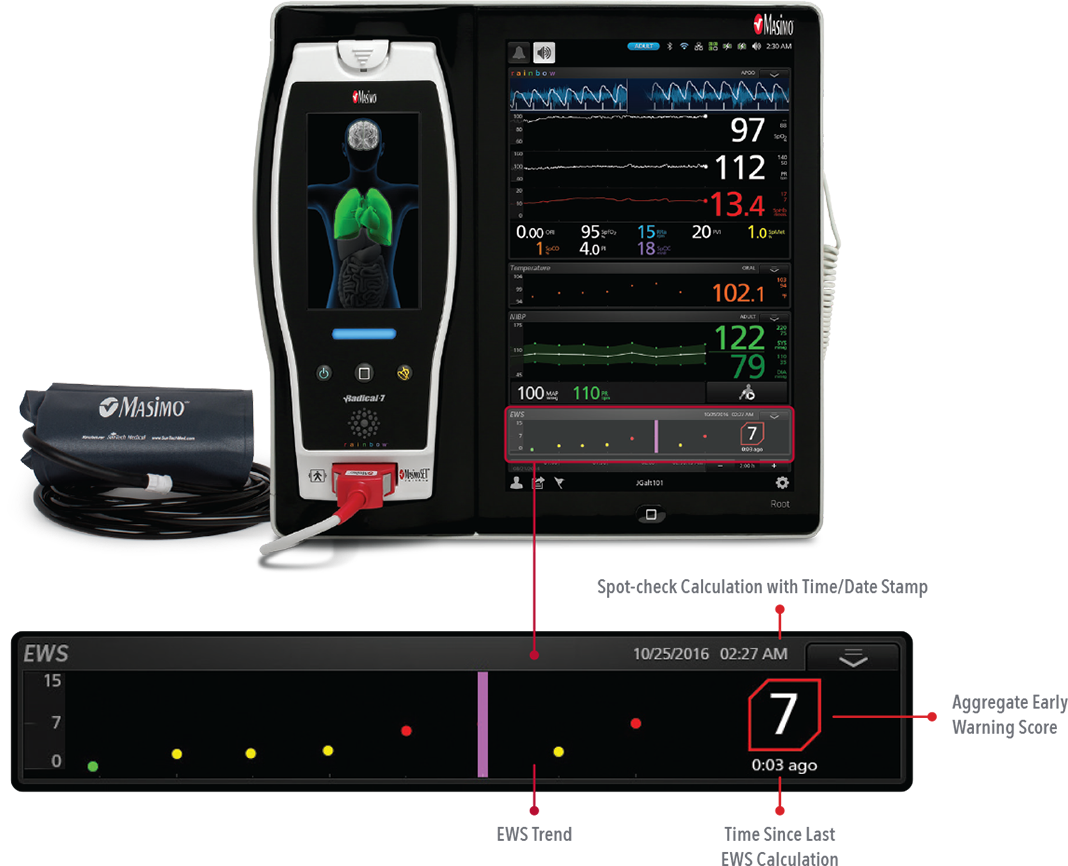 Masimo Root Patient Monitor - NIBP, Temperature & Radical 7 SpO2