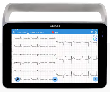 Edan iSE ECG Machine | Portable & Accurate ECG Device
