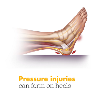 Sage Prevalon Heel Protector Boot 3 | Stryker Home Care