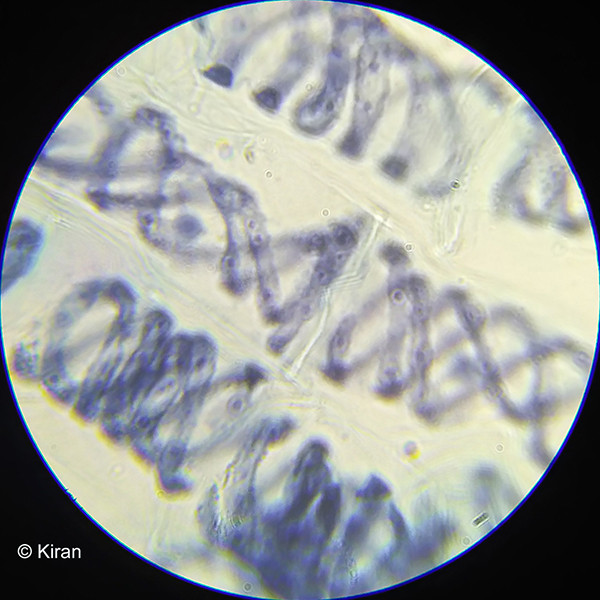 Spirogyra Under the Microscope - Microscope World