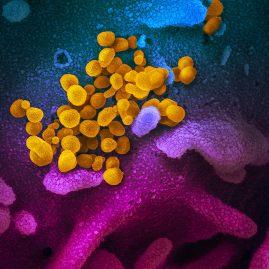 COVID-19 Under the Microscope - Microscope World