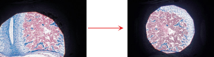 How to Center a Microscope Condenser: Step-by-Step Guide - Microscope World