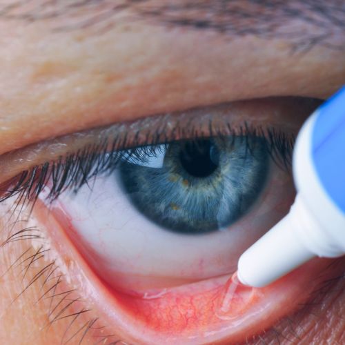 Glaucoma in Kids - What Parents Need to Know - Kids Eye Gear Glaucoma in Kids - What Parents Need to Know - Kids Eye Gear