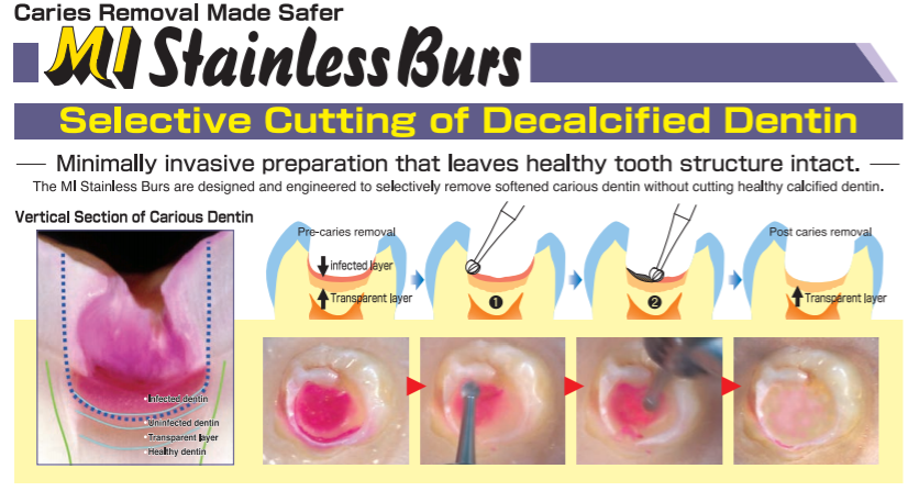 Mani Sutures and Surgical Needles - PrimeHub