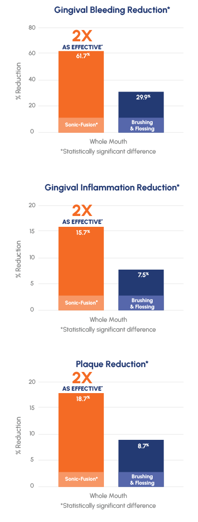Waterpik Sonic-Fusion: Twice as Effective as Regular Brushing ...
