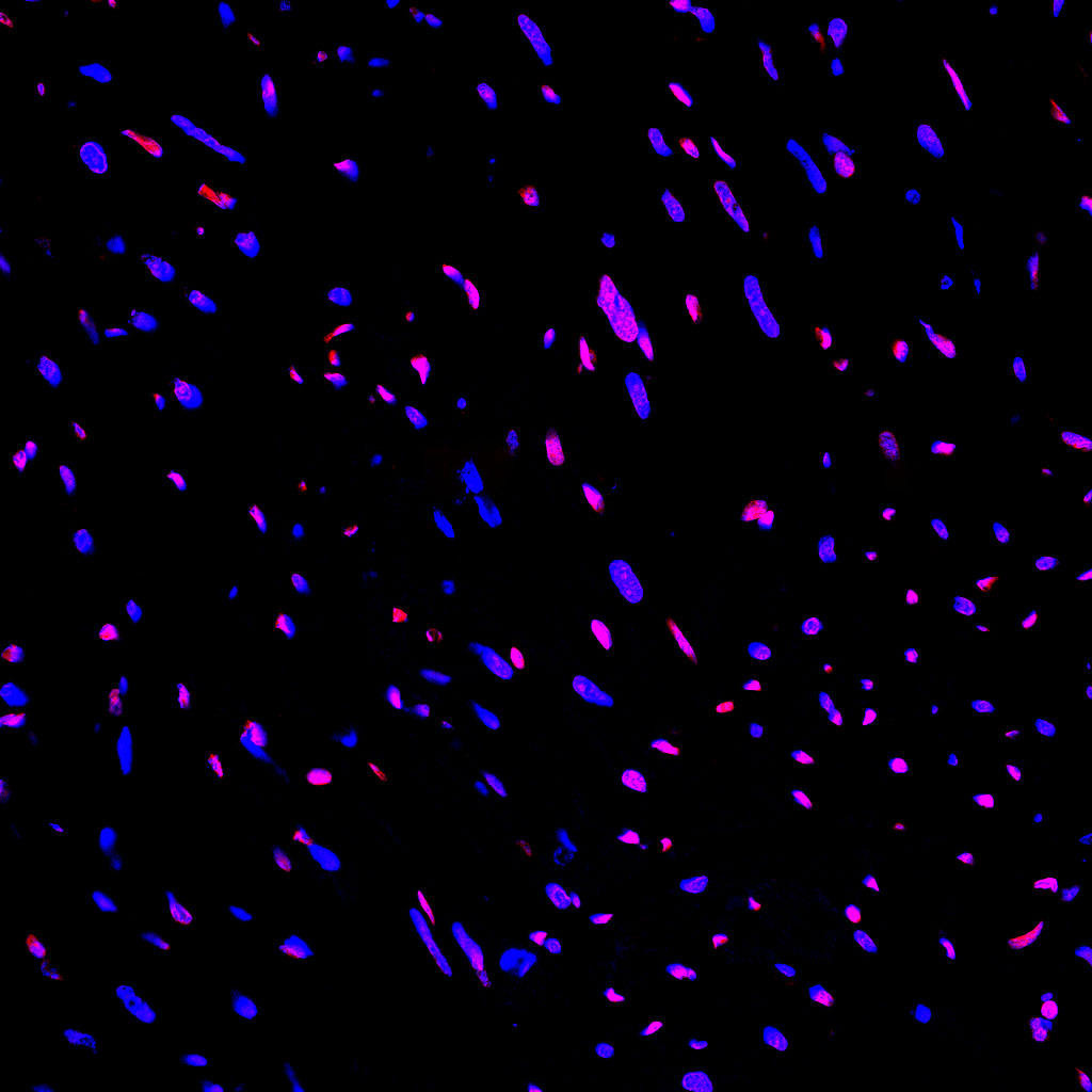TUNEL Apoptosis Assay Kit | Assay Genie