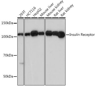 Insulin Receptor Antibody - Human,Mouse,Rat | Assay Genie