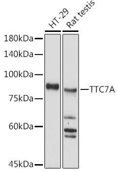 Anti-TTC7A Antibody | Suitable for WB | Highly Sensitive