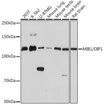 Anti-MIB1/DIP1 Antibody | Suitable for WB | Highly Sensitive
