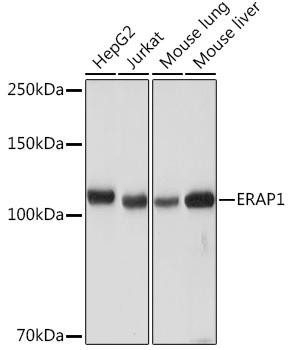 Anti-ERAP1 Antibody | Suitable for WB IHC | Highly Sensitive