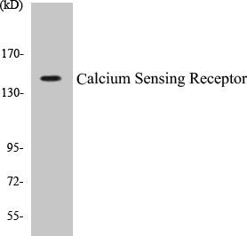 Calcium Sensing Receptor Colorimetric Cell-Based ELISA Kit