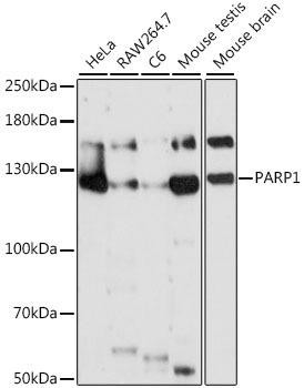 Anti-PARP1 Antibody (CAB0010) | WB, IHC, IF