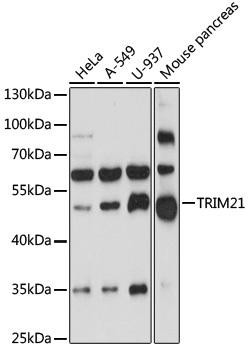 Anti-TRIM21 Antibody (CAB13547) | WB, IHC, IF, IP