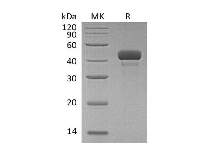 Human Reticulocalbin 3/RCN3 Recombinant Protein (RPES1337)