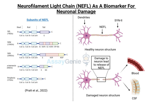 Neurofilament Light chain (NEFL) as a biomarker for neuronal damage ...